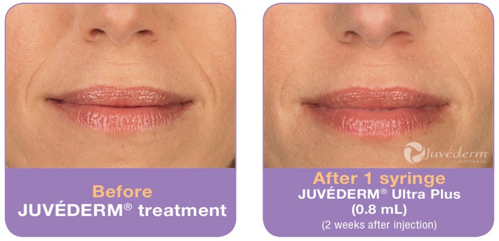 frames - Advanced Dermatology and Skin Care Center