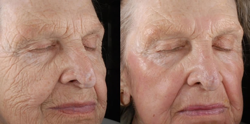 CO21 - Advanced Dermatology and Skin Care Center